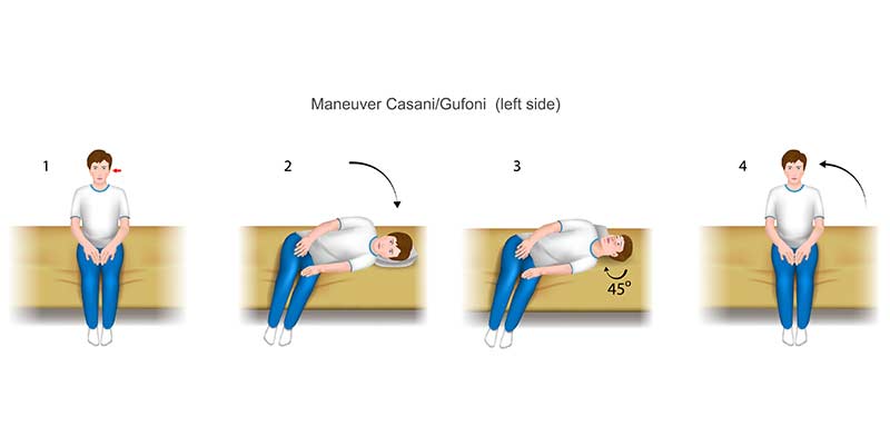 Horizontal Canal BPPV: Diagnosis and Treatment