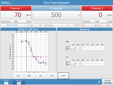 5 Things to Know AudioStar Pro | GSI Blog