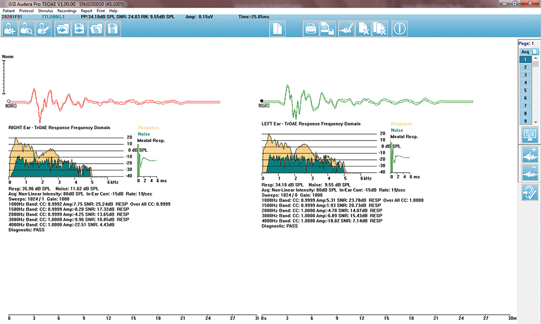 Clinical Evoked Potentials & OAE | Audera Pro | Grason-Stadler