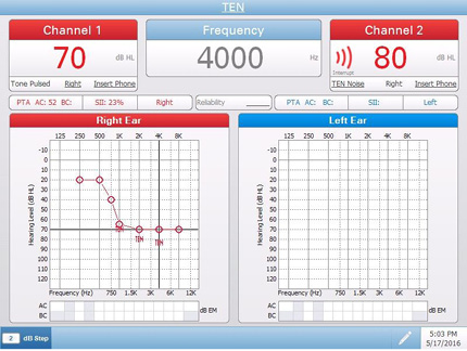 Diagnostic Audiometer | Pello | Grason-Stadler
