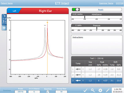 Clinical Tympanometer | TympStar Pro | Grason-Stadler